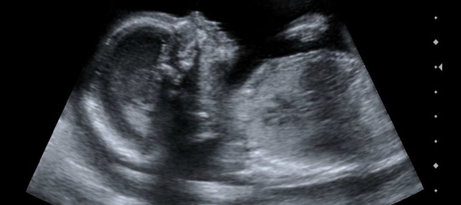 What is an Ultrasound scan? | Clinical Sciences